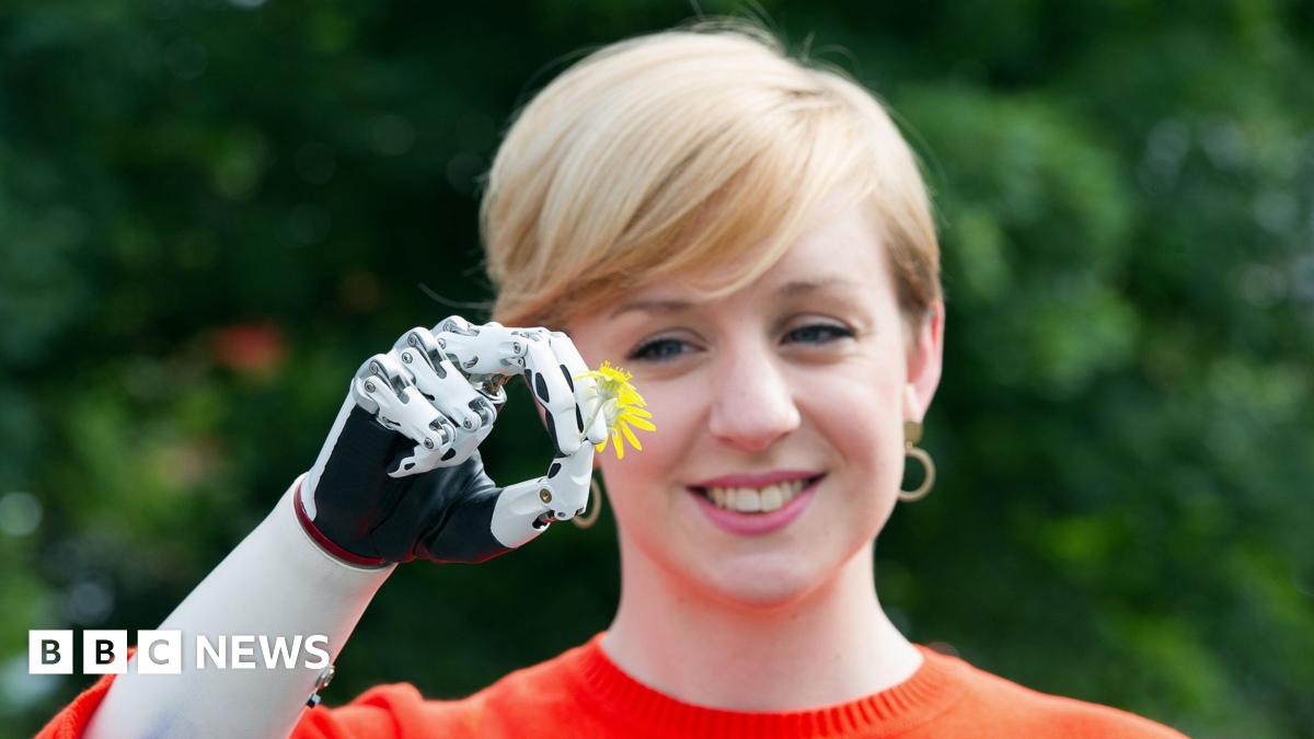 How easy is it for the limbless to get a bionic arm or leg? - BBC News