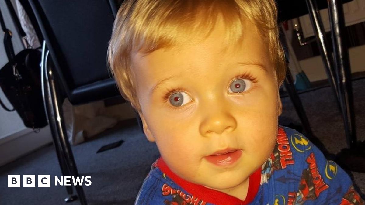 Surgeon: 'How many more children like Kayden must die?' - BBC News