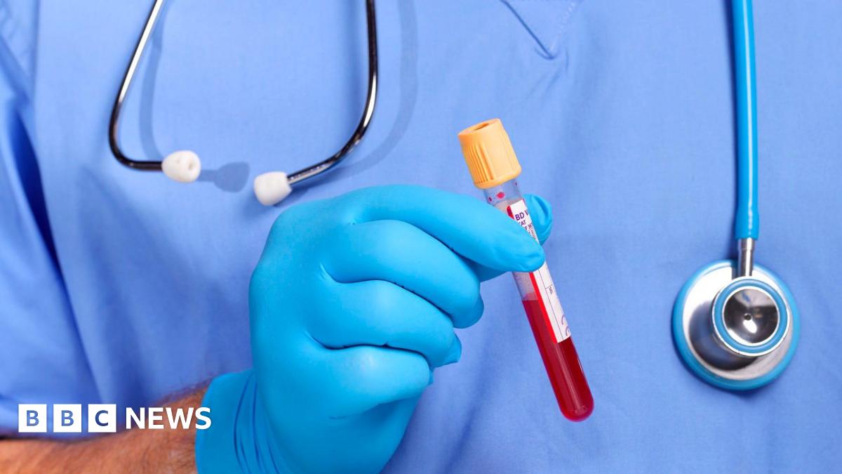 HIV detection drive sees thousands tested in A&E - BBC News