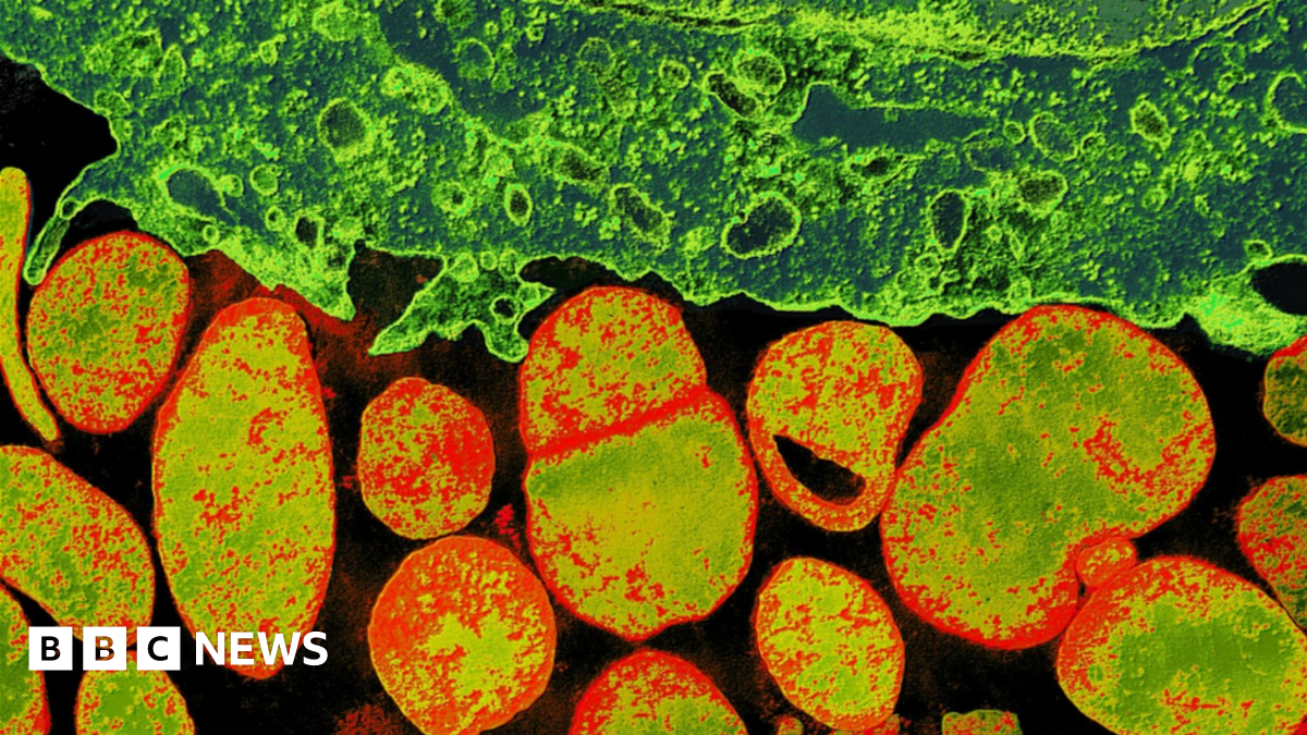 University of Warwick to share £18m in search for new antibiotics - BBC News