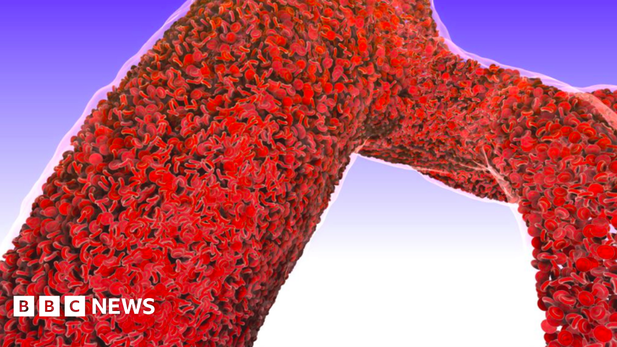 Supercomputer simulates whole-body blood flow - BBC News