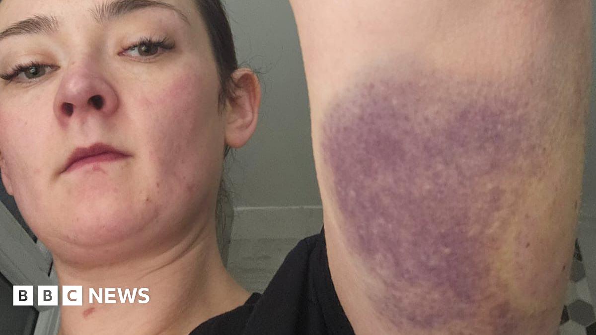 Autism: 'My life has become much worse' says mum of autistic boy - BBC News