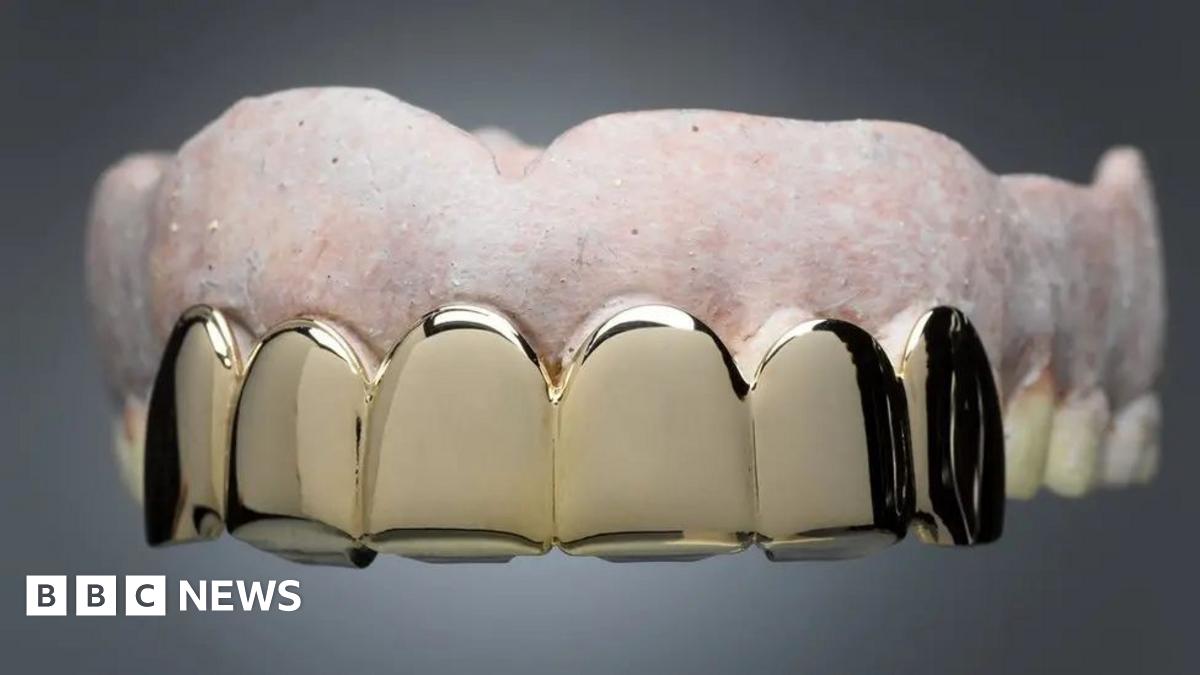 Isle of Wight: False teeth among lost property left on ferries - BBC News