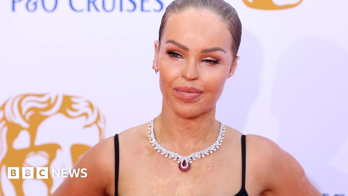 Katie Piper forced to pull out of ITV show last minute - BBC News