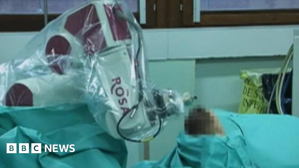 Surgery robot offers hope to seizure sufferer - BBC News