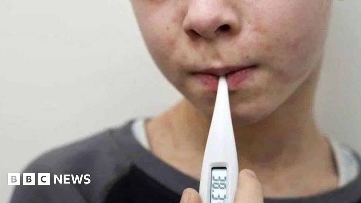'Concerning' measles rise as health chiefs issue warning - BBC News