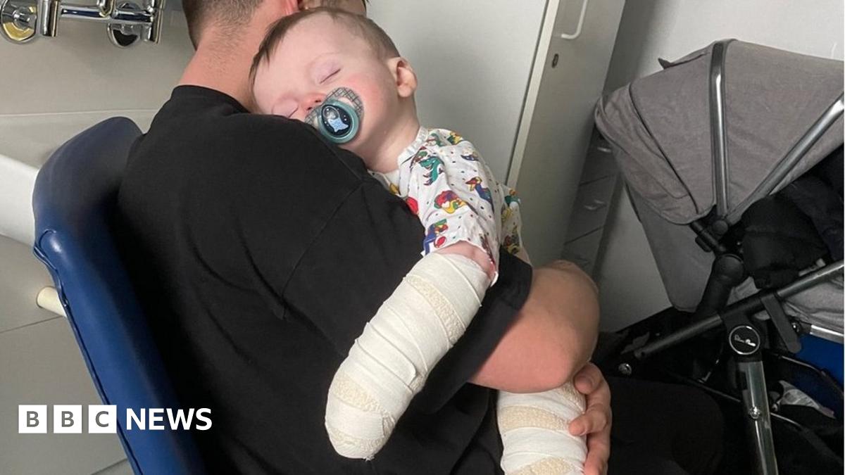 Payout for family of baby badly burned at Aberdeen nursery - BBC News