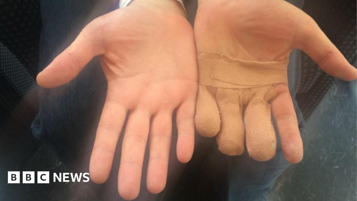 finger cut on rusty metal