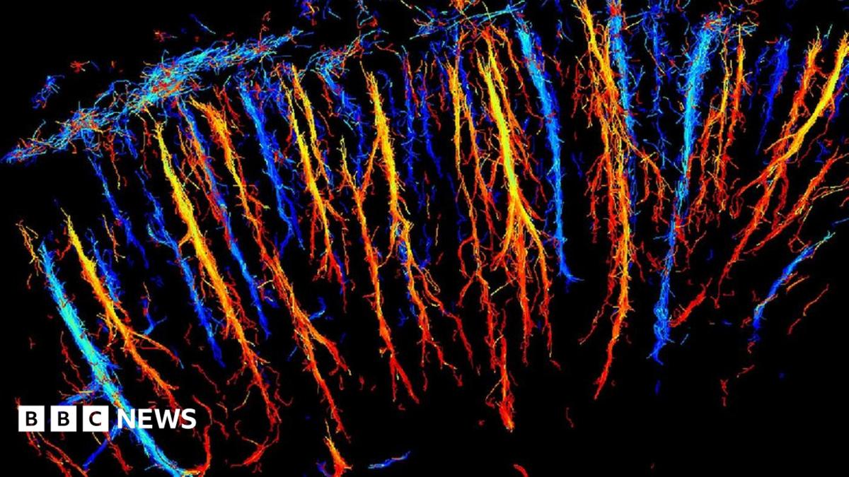 Ultrasound captures rat brain in microscopic 3D - BBC News