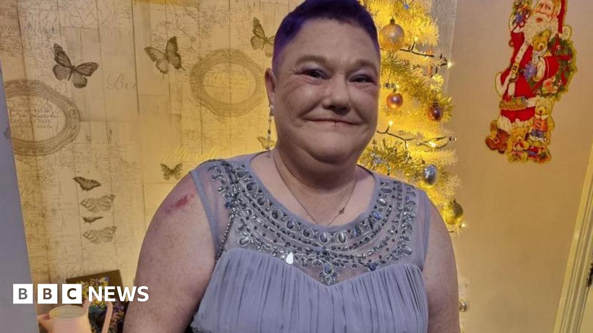 Cancer diagnoses "too late" for people with learning disabilities - BBC ...