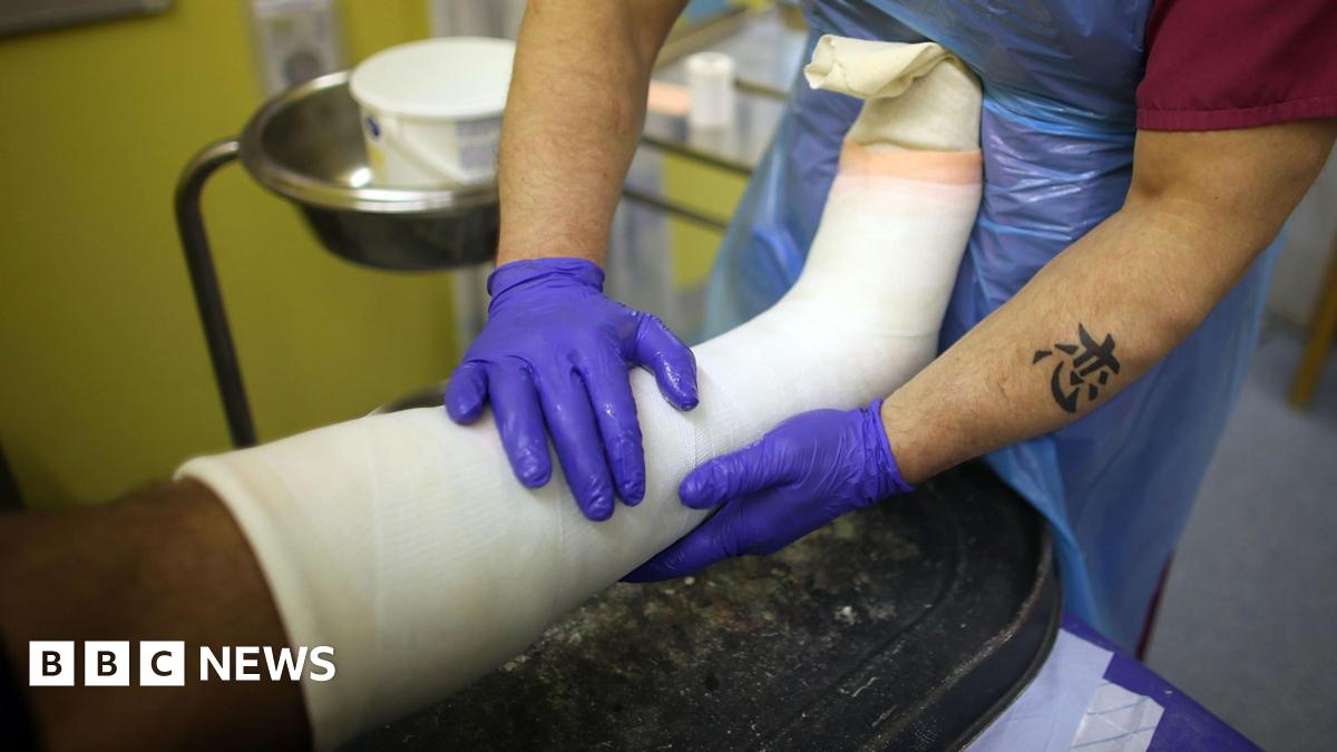 AI to spot broken bones at Northern Lincolnshire and Goole hospitals ...