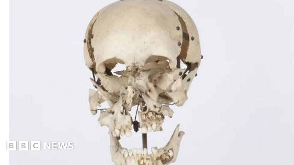 Cambridge: Exploded human Victorian skulls on display at museum - BBC News