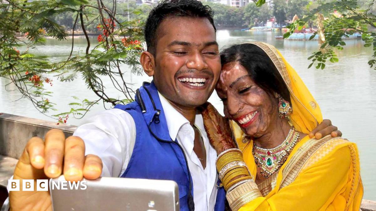 Indian acid-attack bride finds love from a wrong number - BBC News