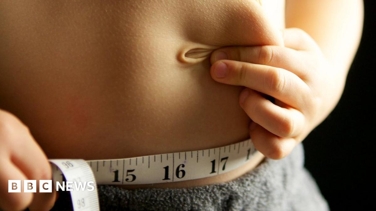 Scotland's child obesity 'far worse than thought' - BBC News