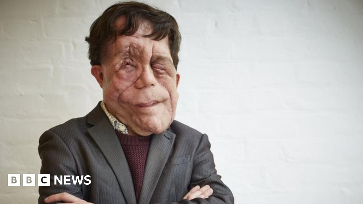 What makes a disability hate crime? - BBC News