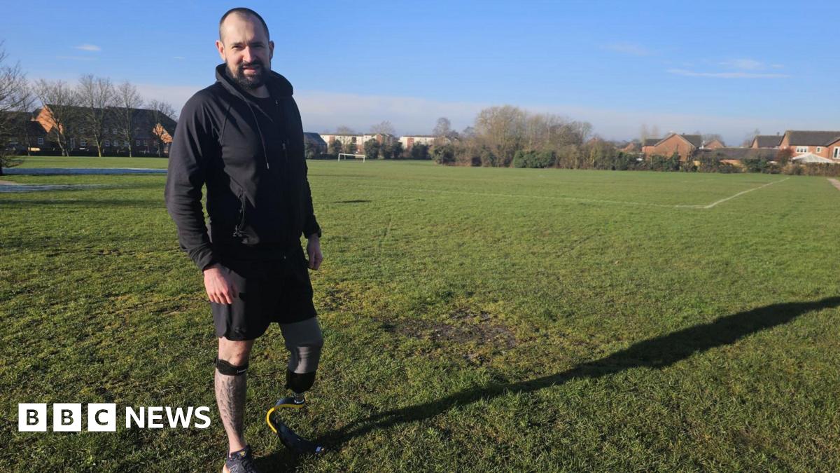Derbyshire man who asked for leg amputation takes on 10km run - BBC News
