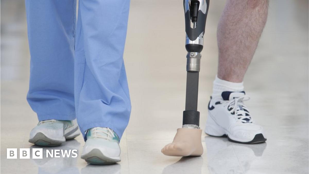 Hull: Payout for man who lost leg after Castle Hill treatment delay ...