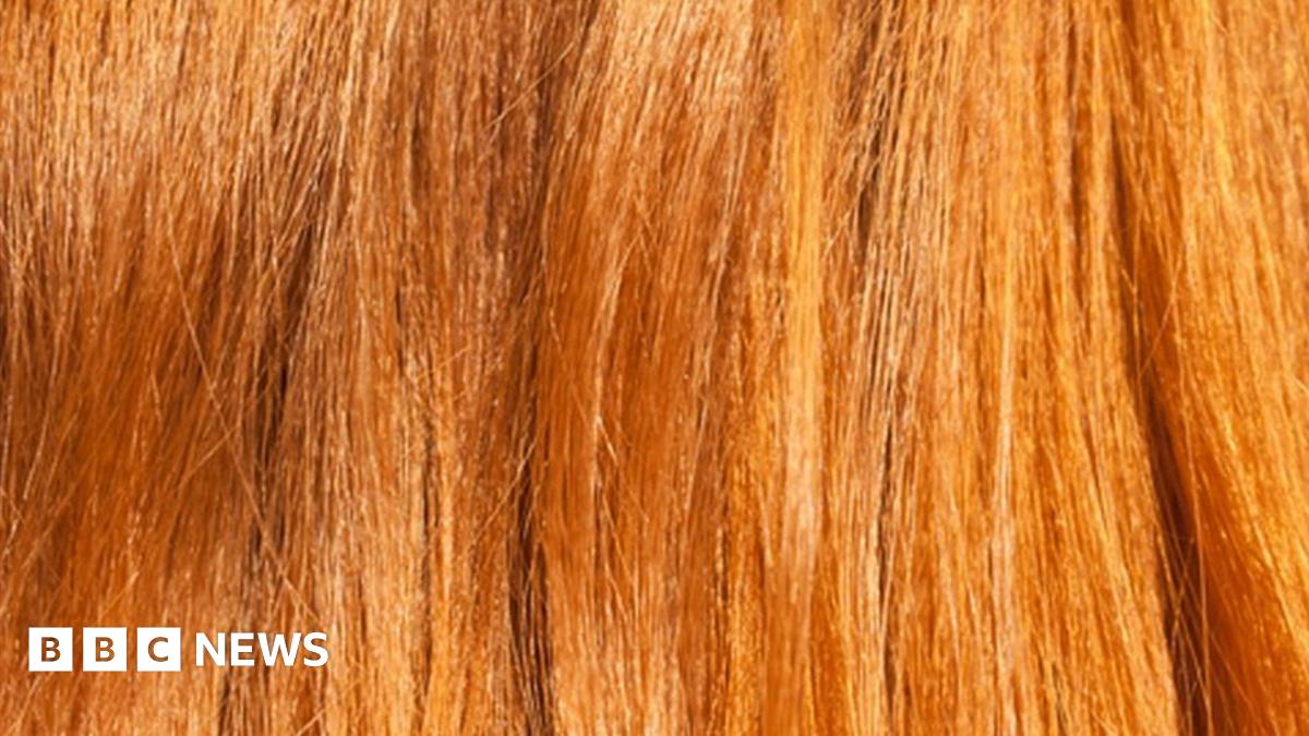 Hidden red hair gene a skin cancer risk - BBC News