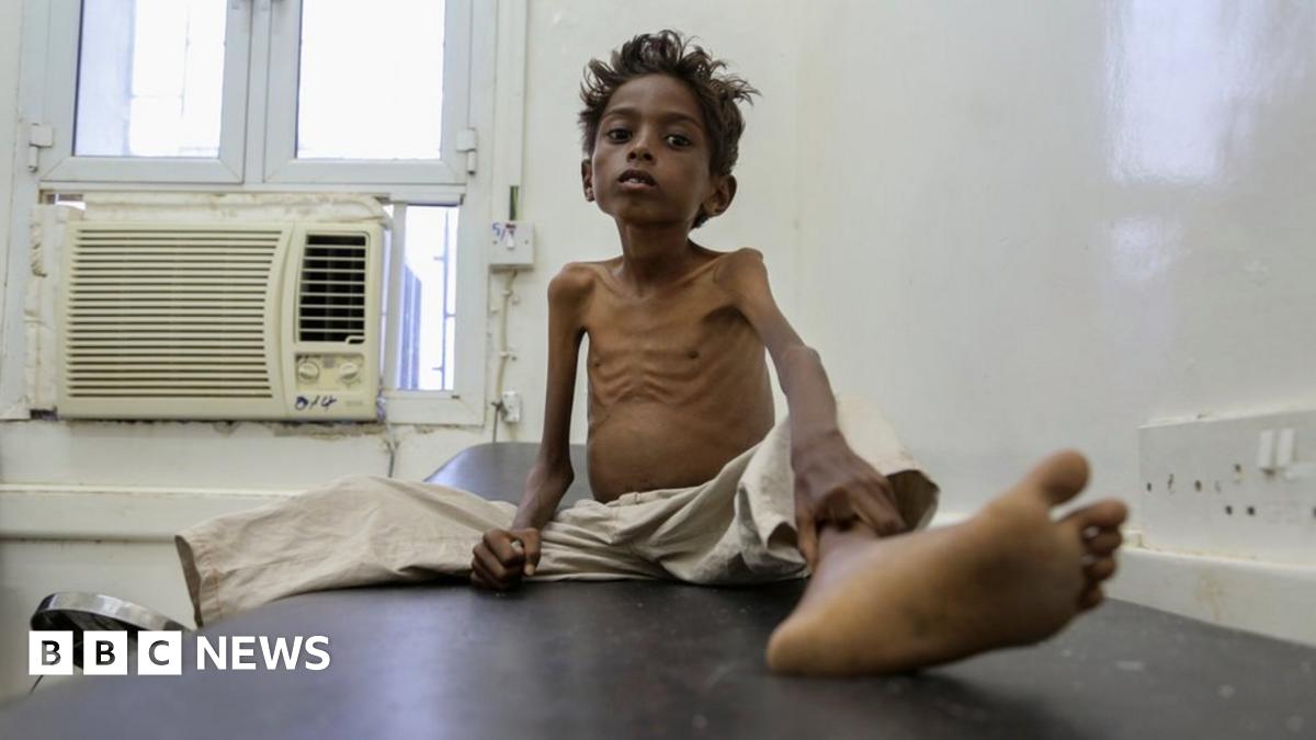 UN: World facing greatest humanitarian crisis since 1945 - BBC News