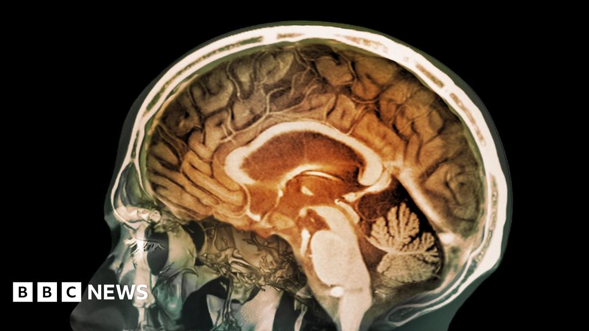 Pollution particles 'get into brain' - BBC News
