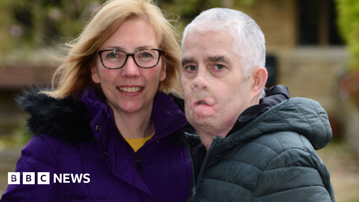 I lost my arms and legs - stop it happening to others - BBC News