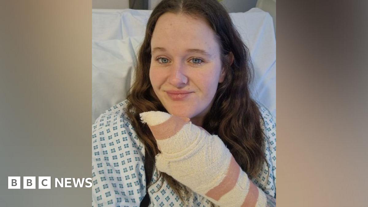 False widow spider bite victim felt finger 'would explode' with pain ...