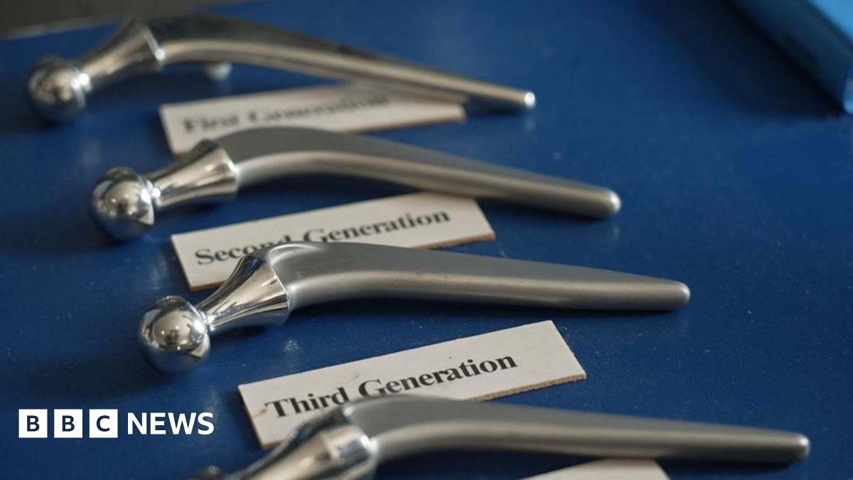 NHS at 75: The professor who made artificial hips in his shed - BBC News