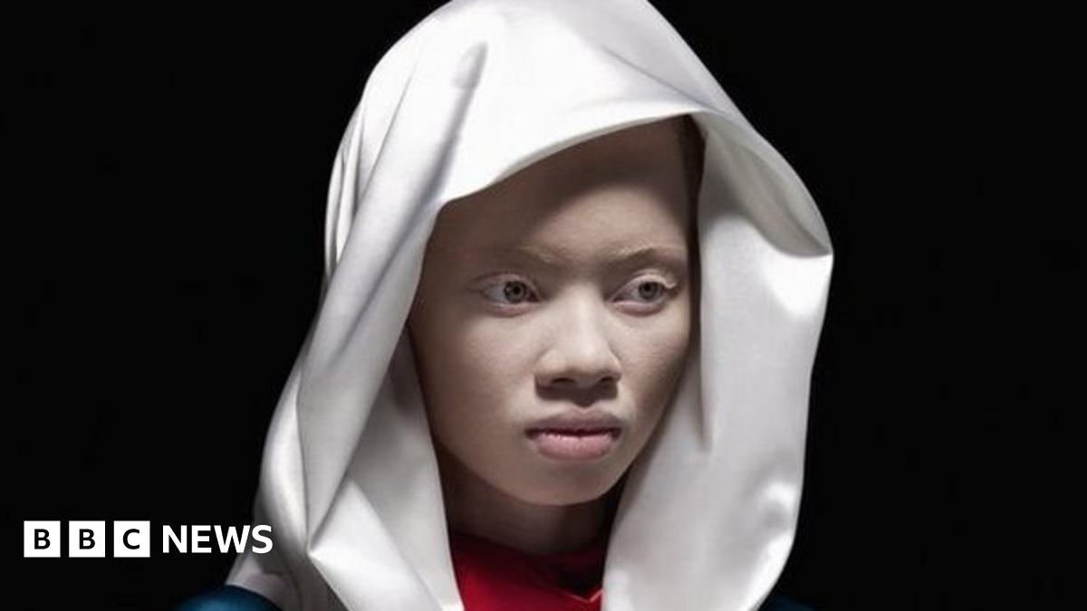 In pictures: Albinism and perceptions of beauty - BBC News