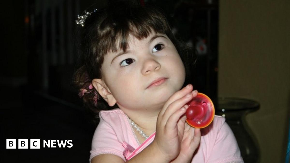 Microcephaly: 'It's not the end of the world' - BBC News