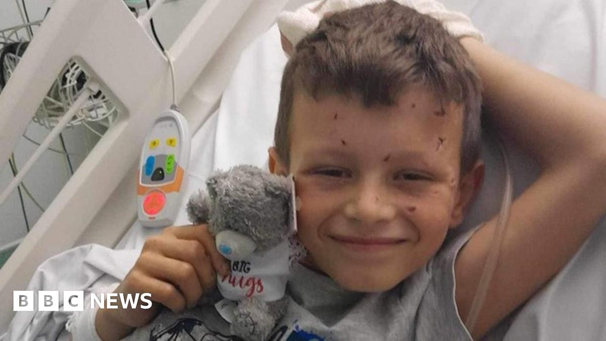 Hengoed boy loses fingers after picking up firework - BBC News