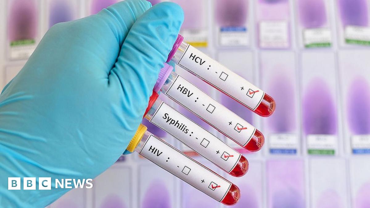 Sexual health: Online STI testing rolled out in Wales - BBC News