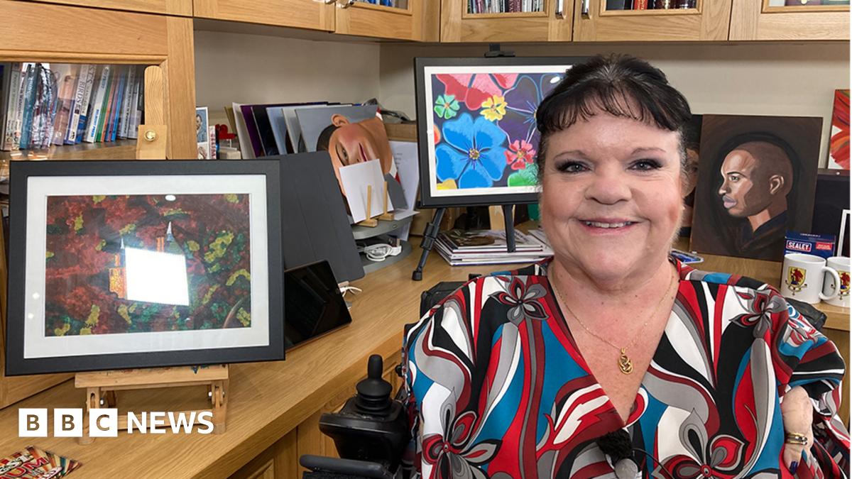 Thalidomide survivor in Wales welcomes lifelong support offer - BBC News