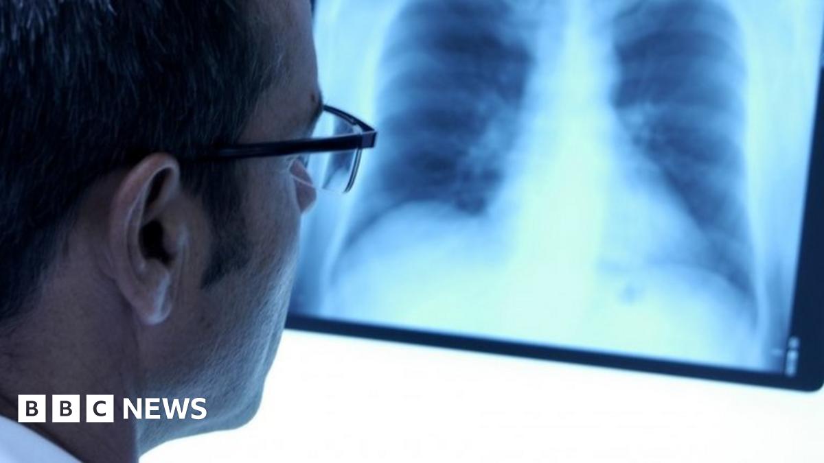 Computer virus alters cancer scan images - BBC News