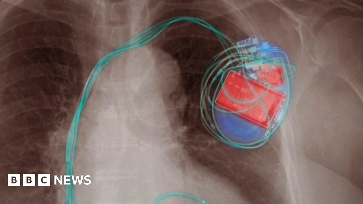 Apple lists products that pose risk to pacemakers - BBC News