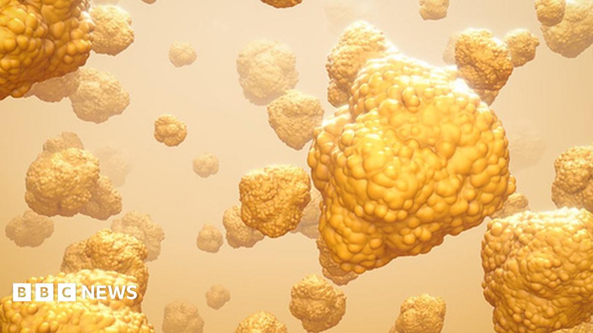 Fat may fuel prostate cancer growth - BBC News