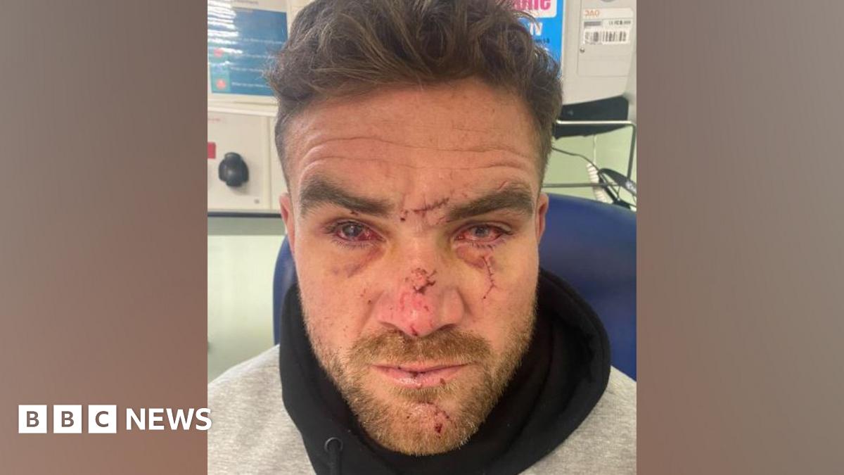 Leeds nightclub attack: Thousands raised for man blinded with glass ...