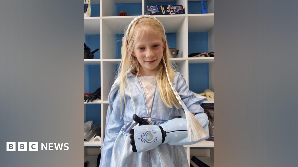 Norfolk girl youngest in England with bionic Hero Arm - BBC News