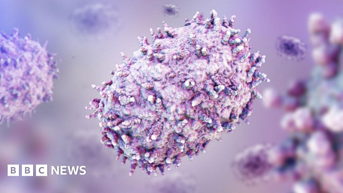 Mpox risk to UK low but medics on alert - BBC News