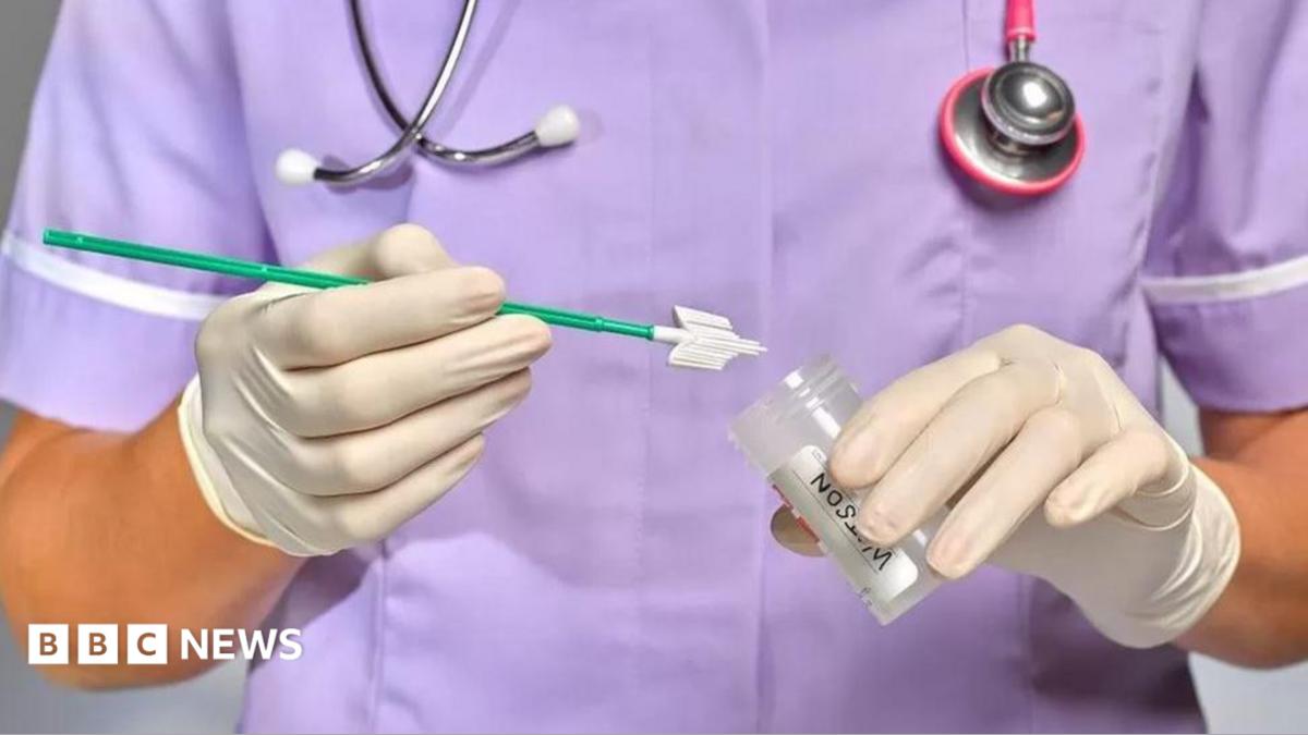 Cervical screening clinics for NHS staff at Wolverhampton trust - BBC News