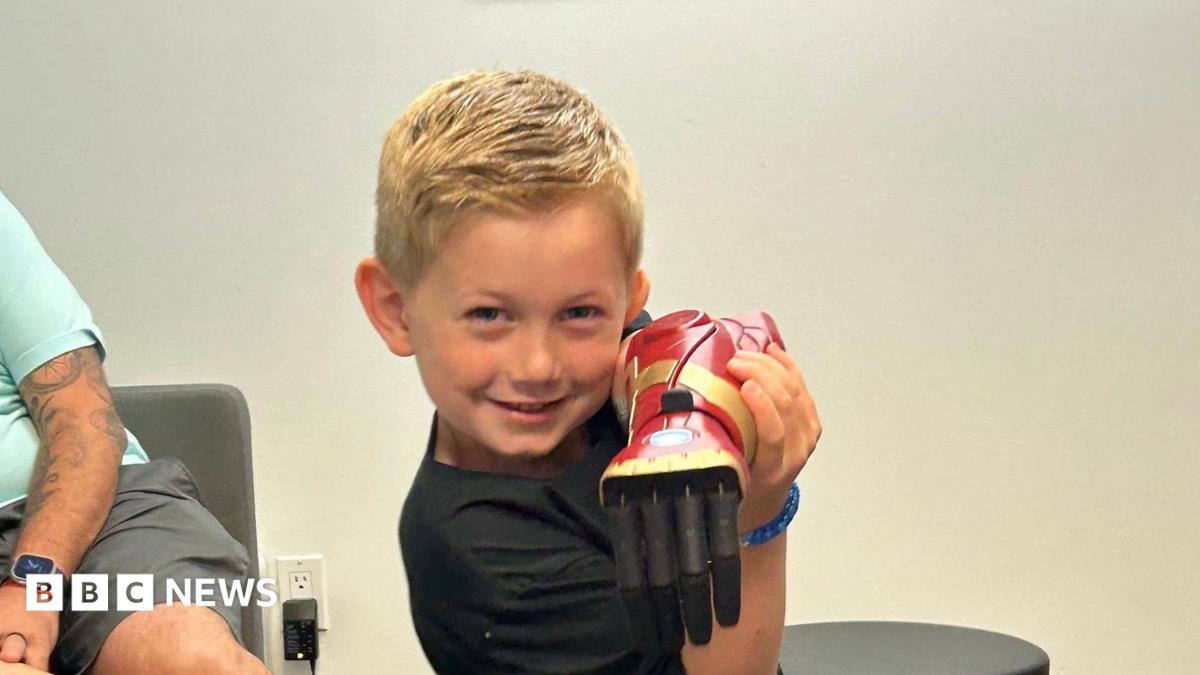 Boy, five, is world’s youngest to receive bionic hero arm - BBC News
