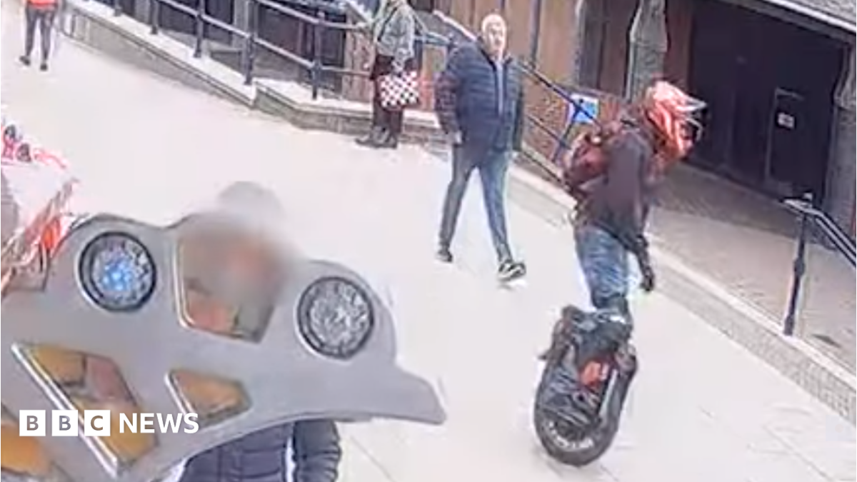Felixstowe unicycle crash left toddler with fractured skull - BBC News