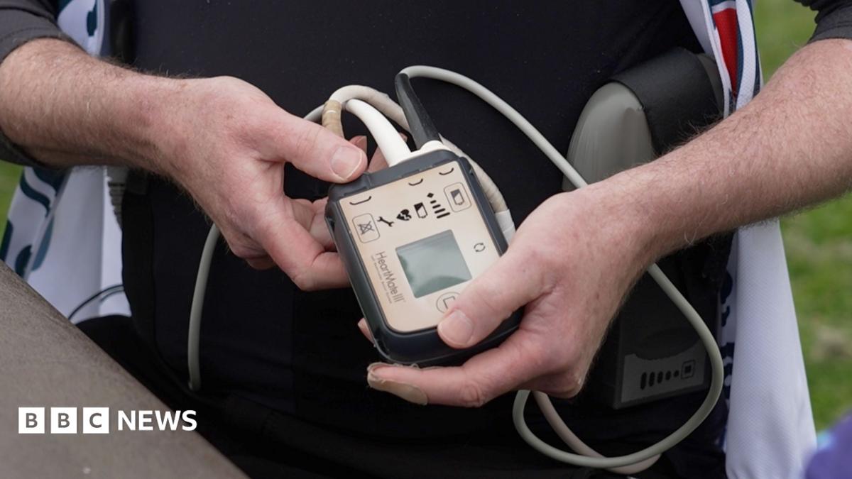 How LVAD heart pumps give patients years of extra life - BBC News