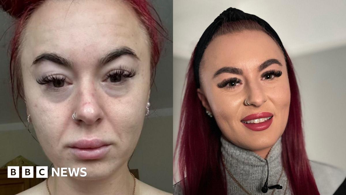 Ketamine addict warns of drug's impact on users - BBC News