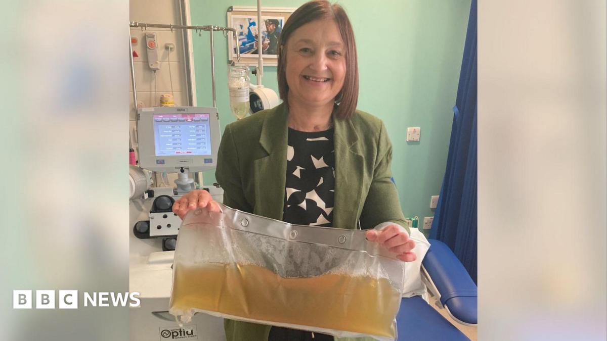 'World first' for double hand transplant patient from Hull - BBC News