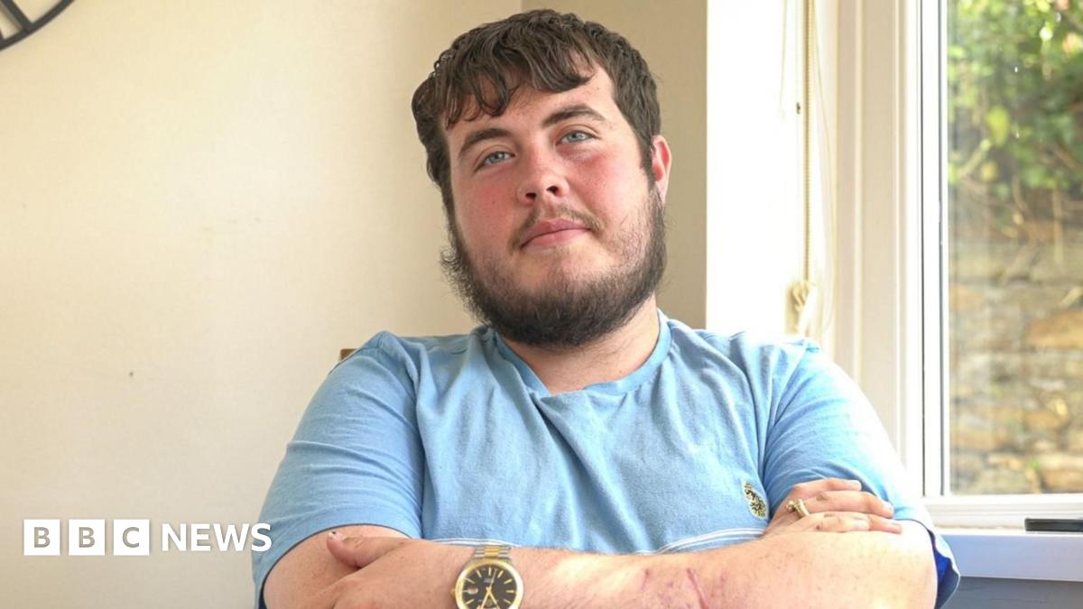 Cardiff man says triple dog attack has left him with nightmares - BBC News