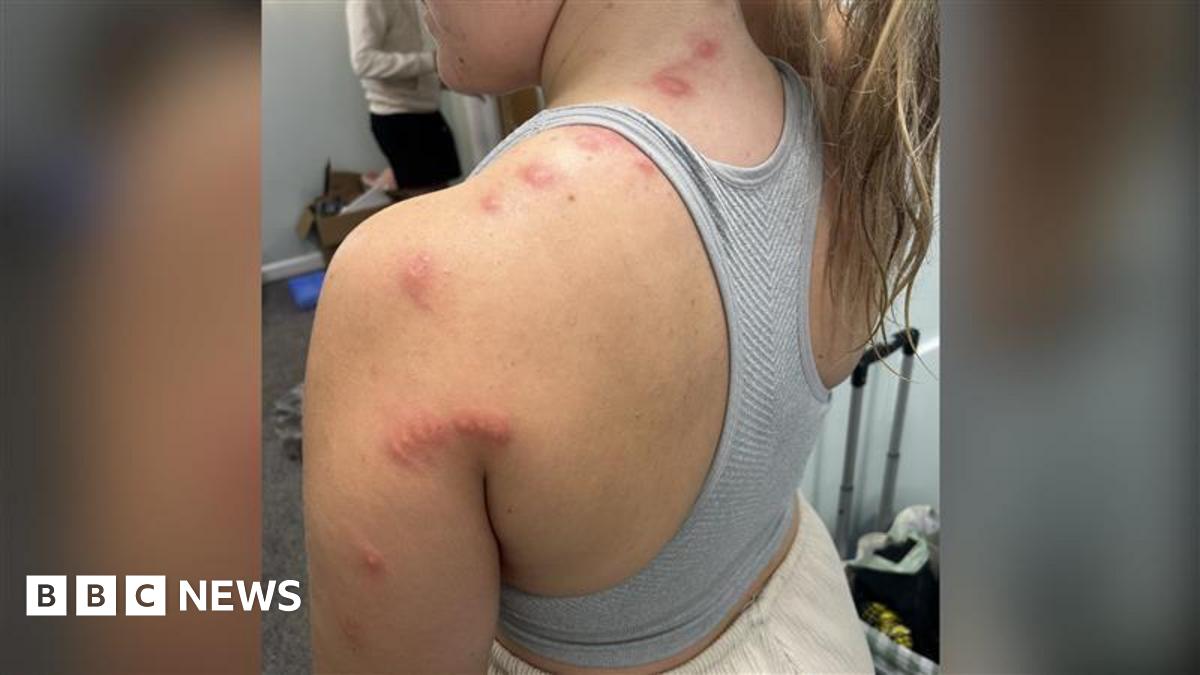 Bognor Regis Butlin's trip cut short due to suspected bed bugs - BBC News