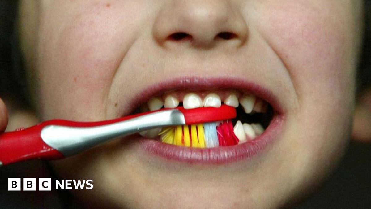 A third of Blackpool's five-year-olds have tooth decay says MP - BBC News
