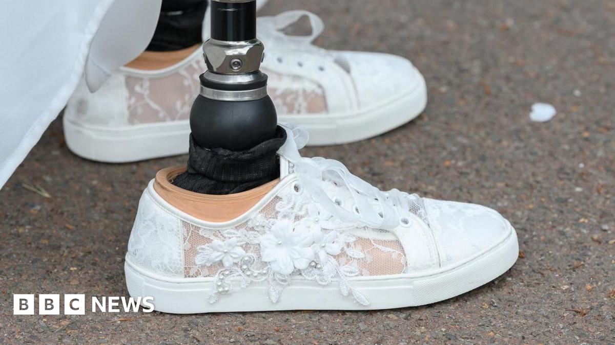 Sepsis survivor: 'I walked down the aisle after losing my legs' - BBC News