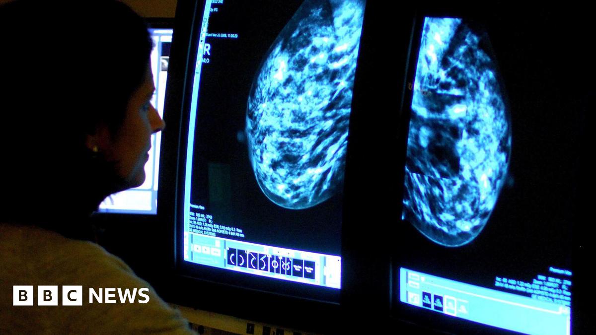 Extra funding for secondary breast cancer research in Sheffield - BBC News