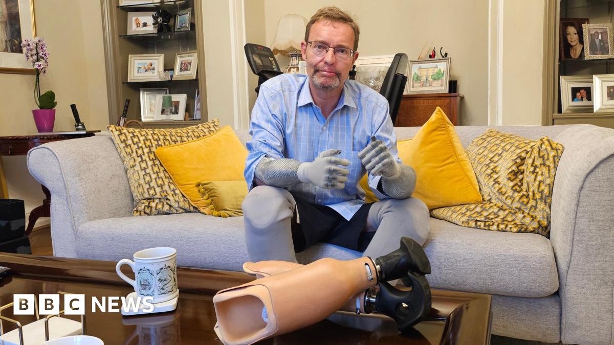 'Bionic' Lord Mackinlay to meet health secretary over limb loss - BBC News